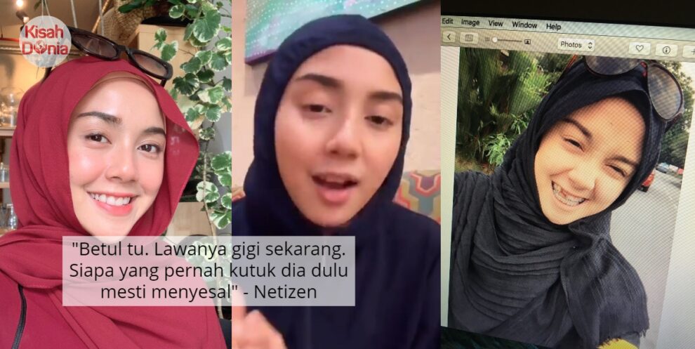 [VIDEO] Viral Dikutuk 9 Tahun Gigi Rongak, Wanita Ini Kongsi Pesanan ...
